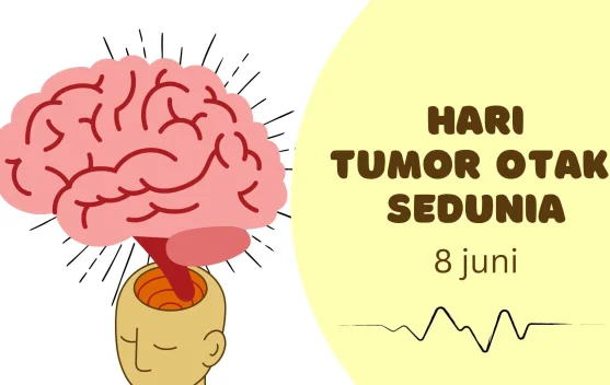 Hari Tumor Otak Sedunia Ingatkan Pentingnya Kesehatan Otak - RRI.co.id