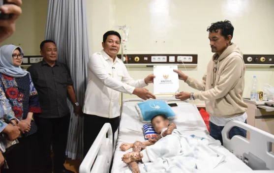 Pemkab Sidoarjo Tanggung Pengobatan Bocah Korban Kebakaran - RRI.co.id